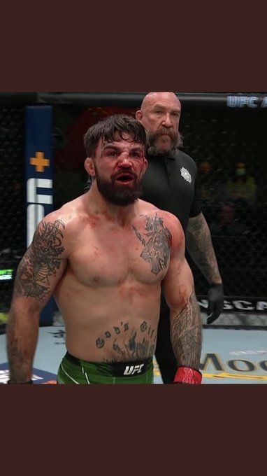 Doctor gives medical breakdown after MMA fighter suffers horrific nose ...