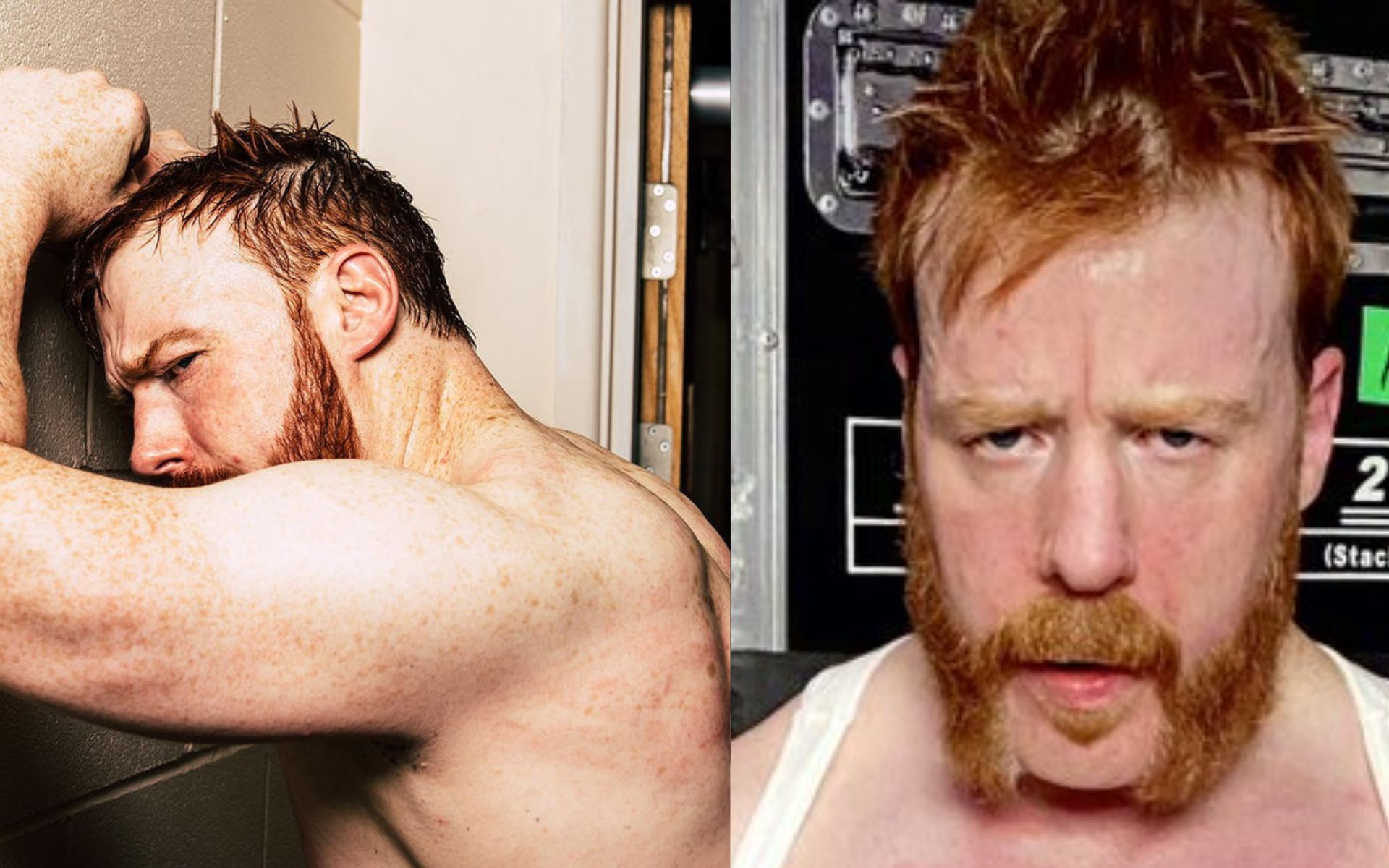 [Photo] Sheamus posts picture of wounds after brutal attack on WWE ...