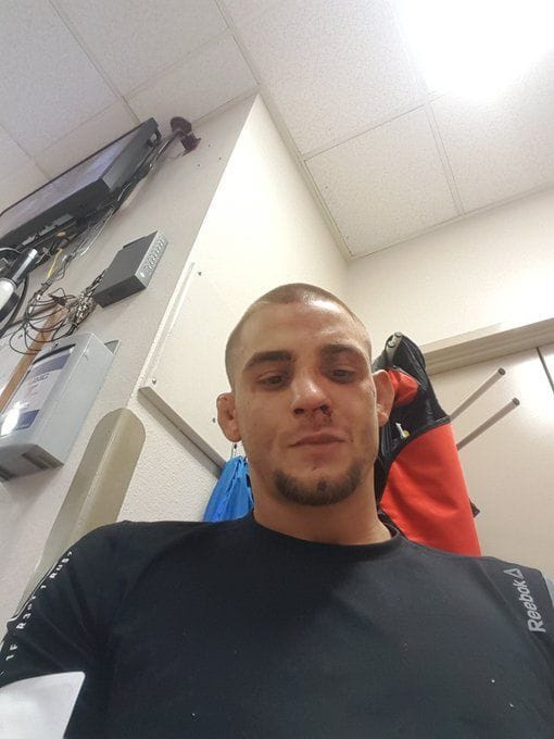 UFC: Dustin Poirier admits that his disfigured nose resulted from a ...