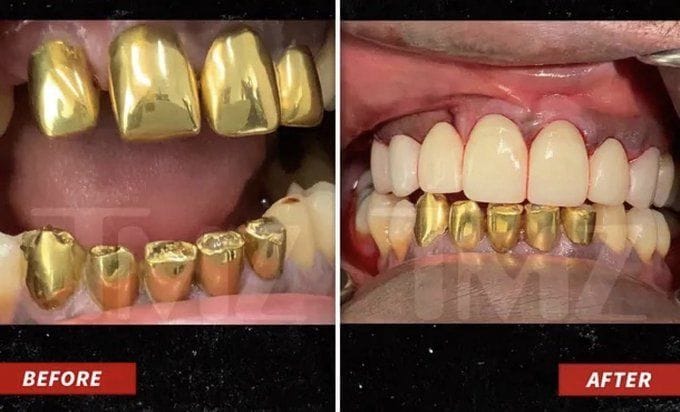 What happened to Trick Daddy's face? Before and after pictures go viral ...