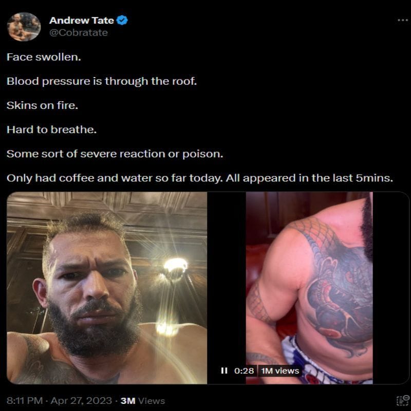 "Skins on fire": Andrew Tate concerned with being poisoned, shares ...