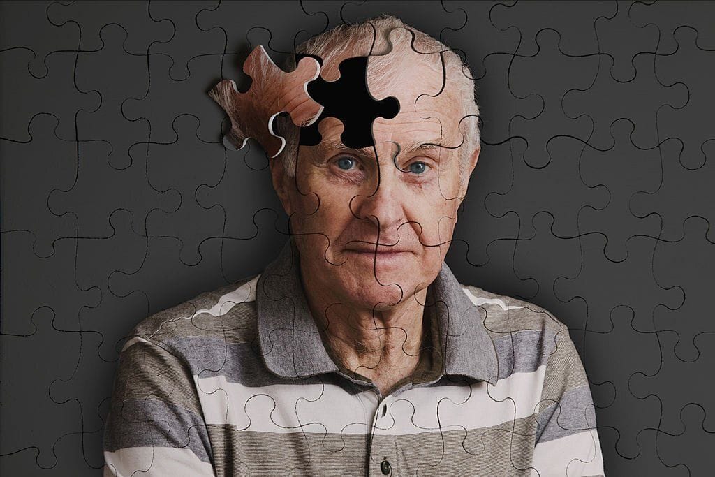 The Science of Forgetting: Understanding the Causes of Memory Loss