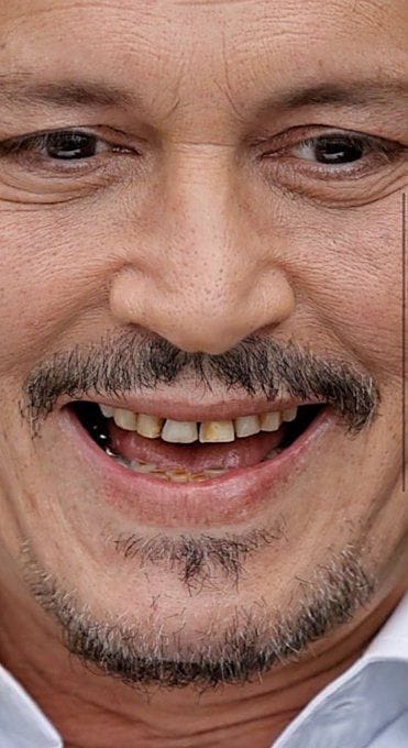"Rum, drugs, alimony": Johnny Depp's teeth leave netizens repelled