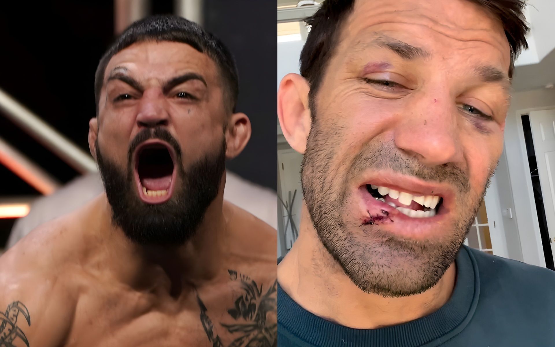 Luke Rockhold: Mike Perry shows gaping wound on his knuckles from ...